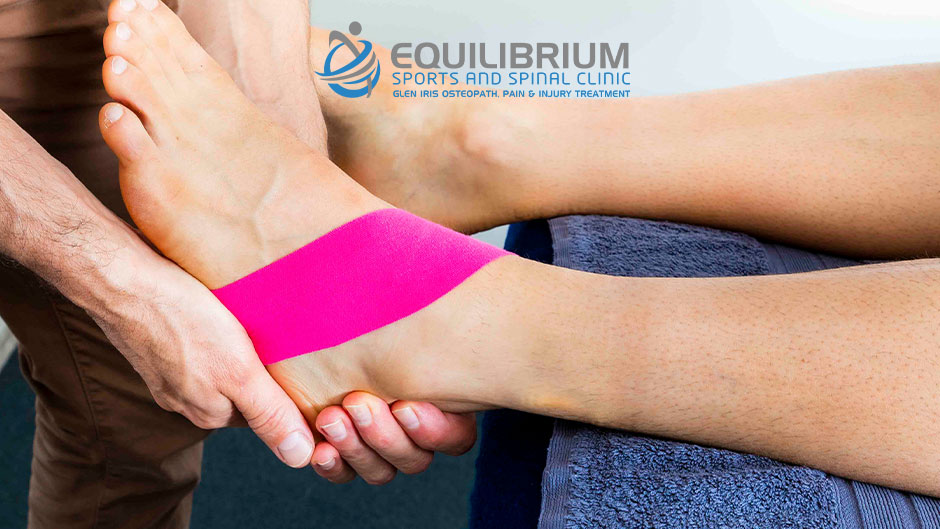 High Ankle Sprain. Syndesmosis Injury - Equilibrium Sports and Spinal ...