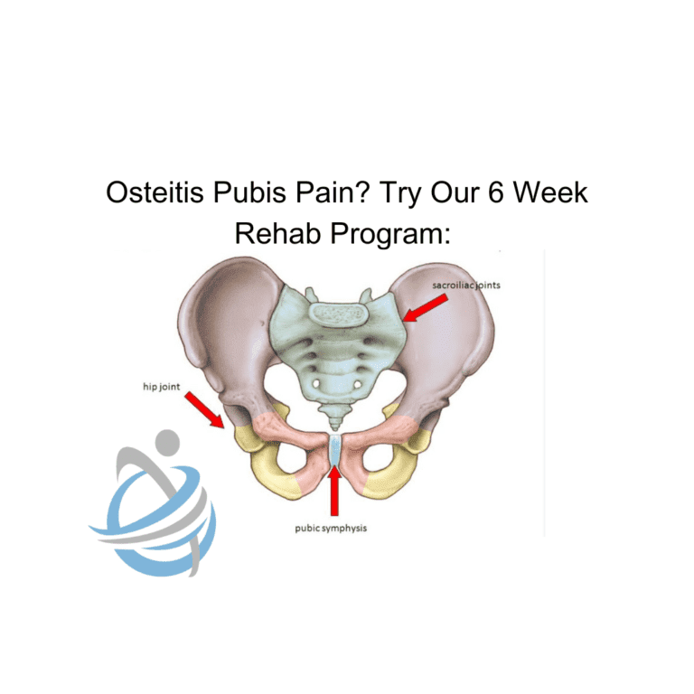 Struggling with Osteitis Pubis?Try this 6 Week Rehab Program