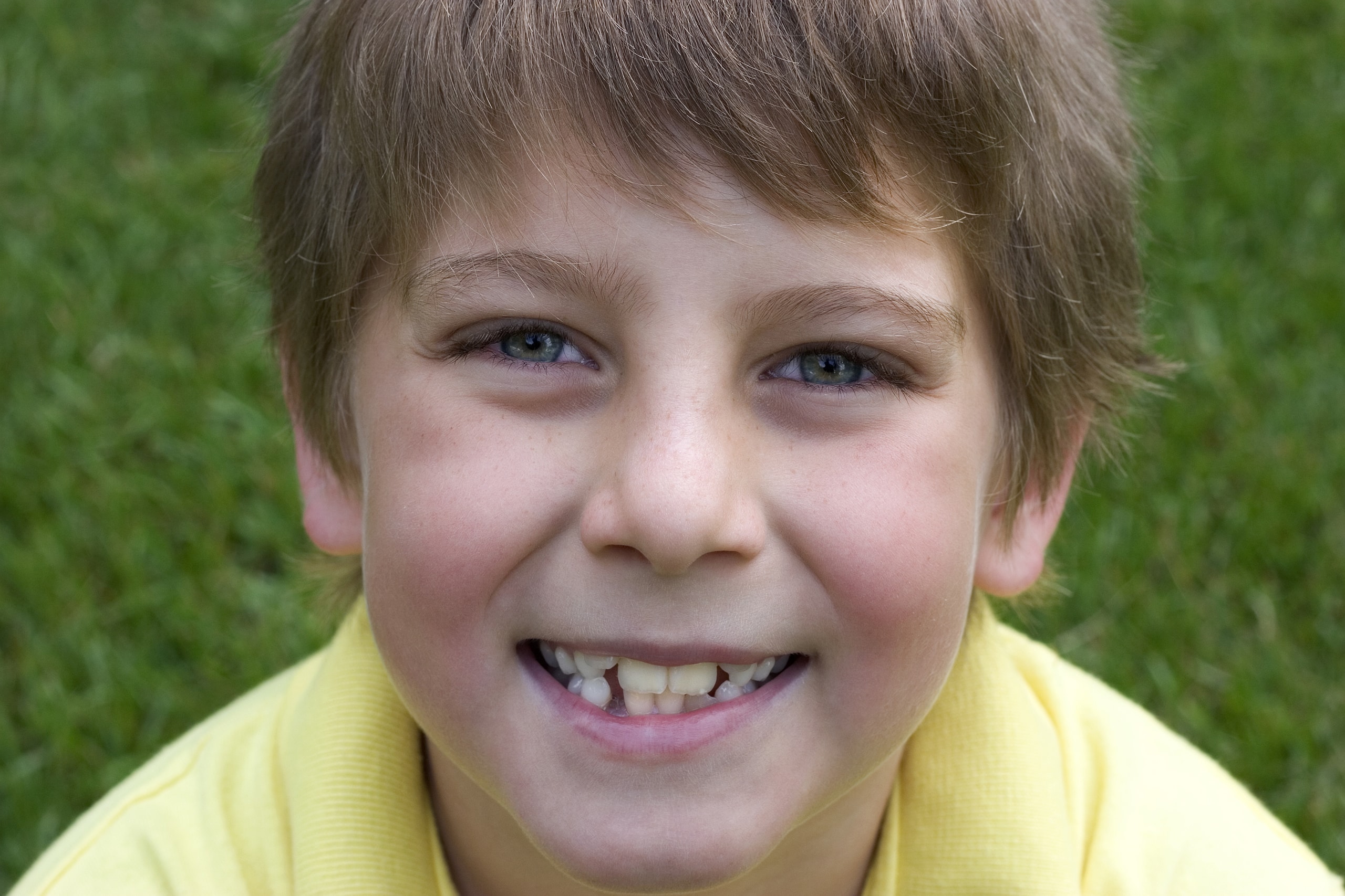 Tooth Exposure Treatment