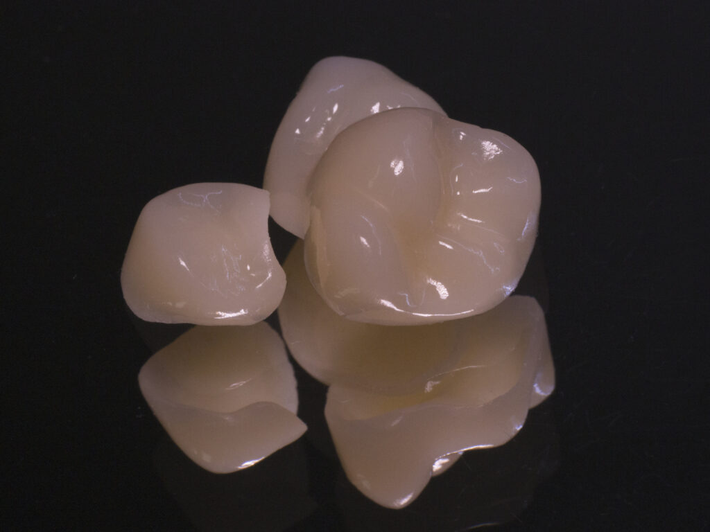 Mercury Amalgam Removal - Heal Dental Care