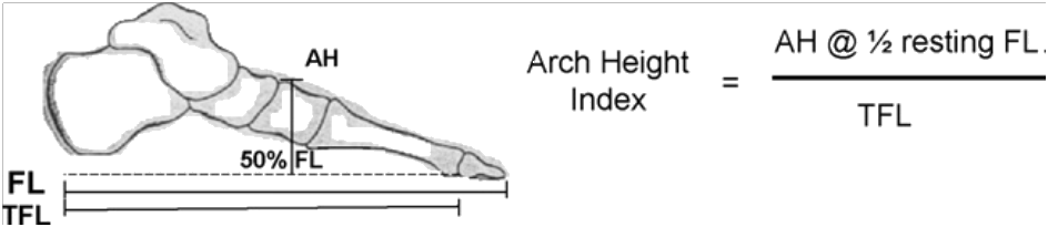 Are You Running With A High or Low Arch? – Hilton Chiropractor