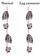 Lower Limb Injury – Hilton Chiropractor