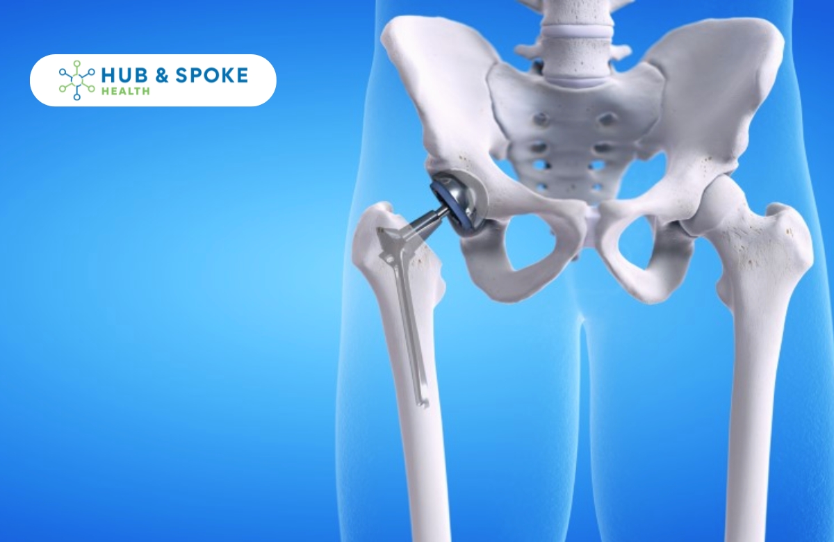 Preparing For Total Hip Replacement | Hub & Spoke Health