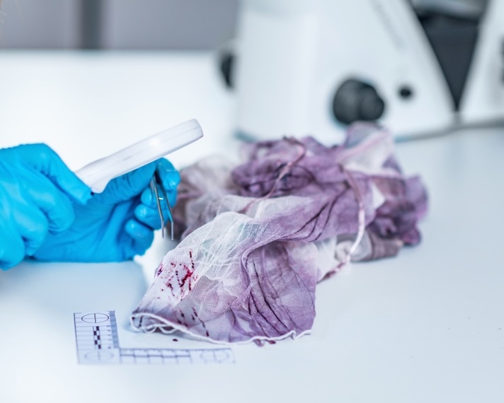 Biological Fluid Testing | Independent Forensic Services