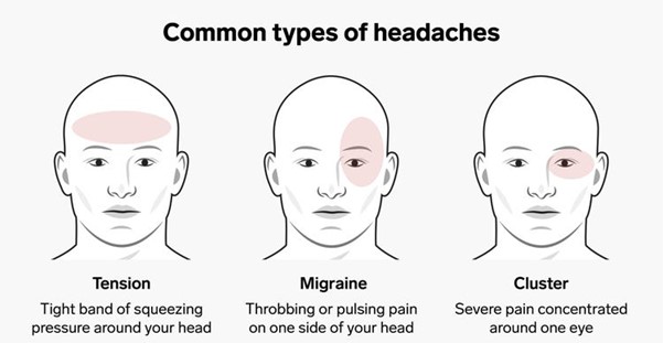 Relief from Headaches through Physiotherapy Treatment - Inertia Health ...