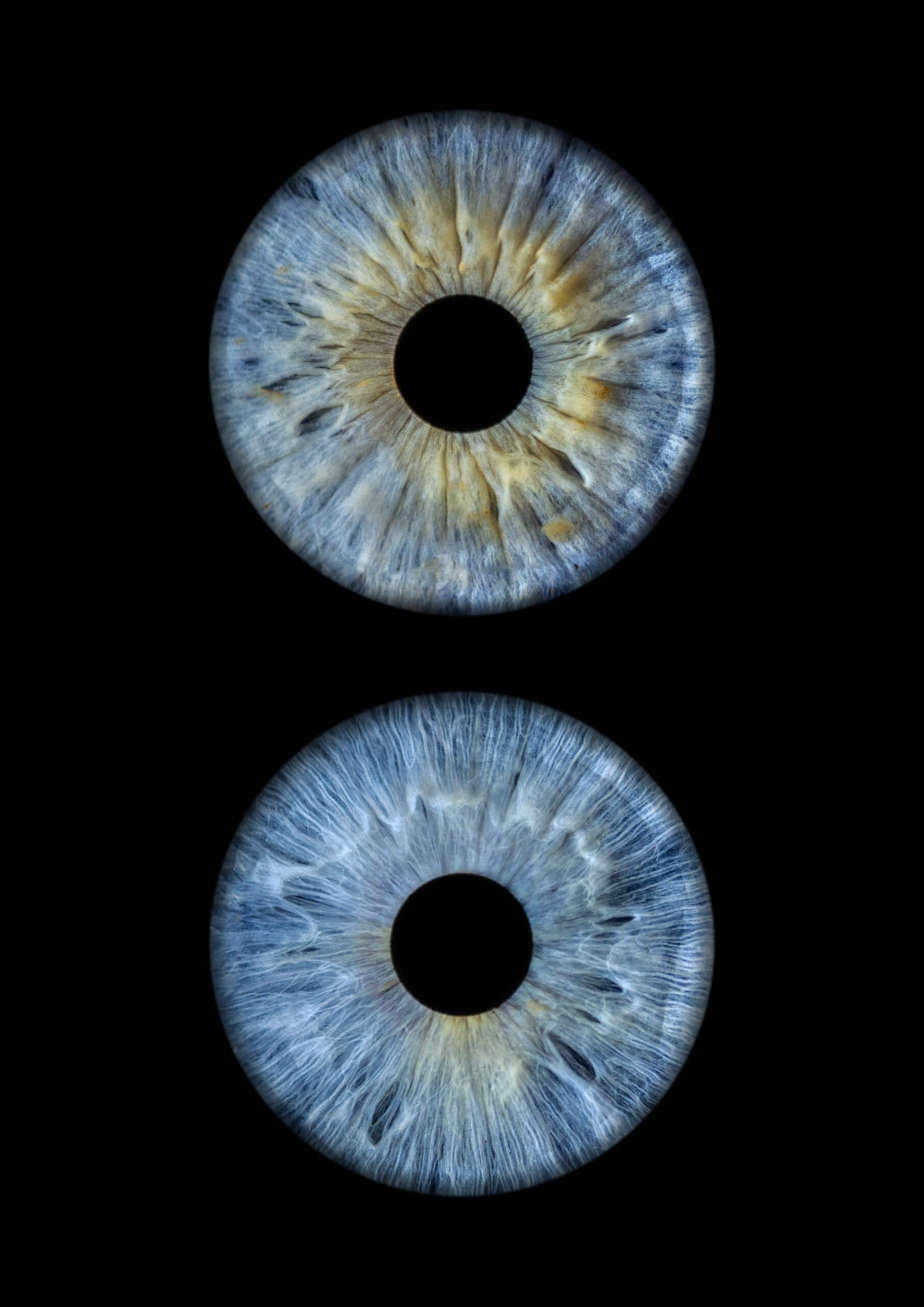 Double Iris Print - Iris Photo