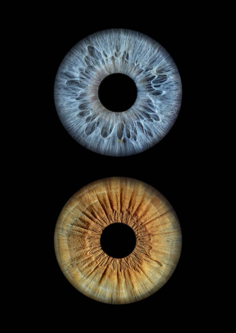 Double Iris Print - Iris Photo