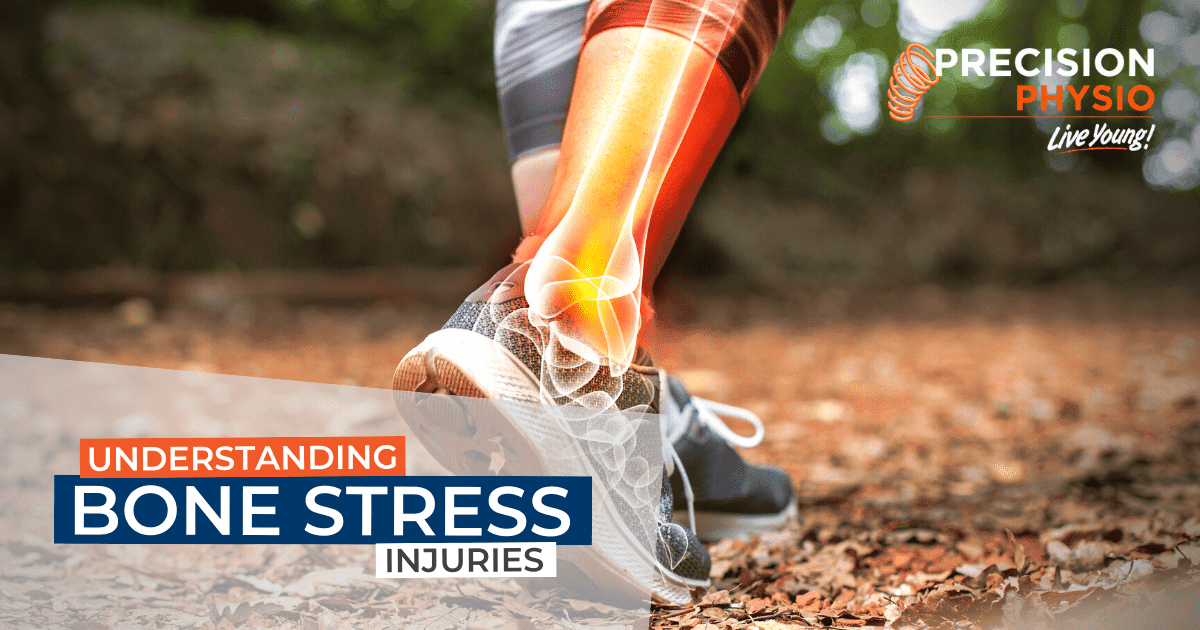 Understand Bone Stress Injuires | Precision Physio