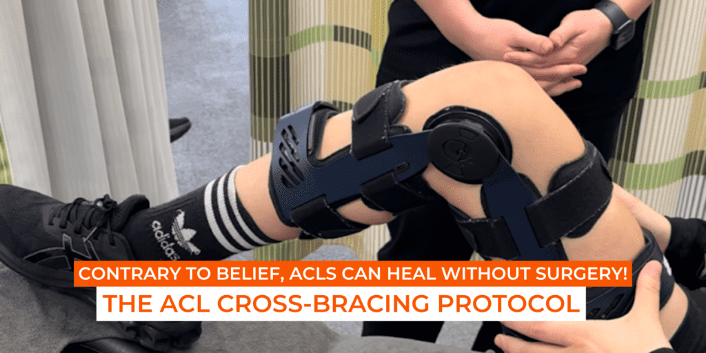 Contrary to belief, ACLs can heal without surgery! —from a physio