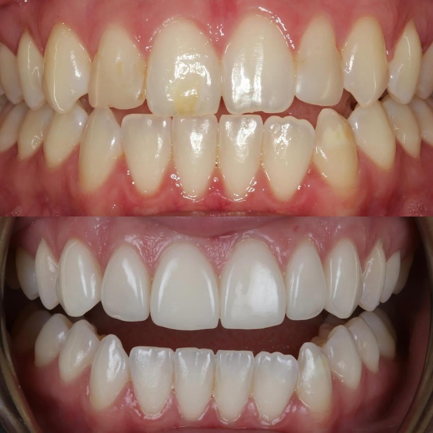 Smile Gallery | Dentist Wellington Point | The Dental Project