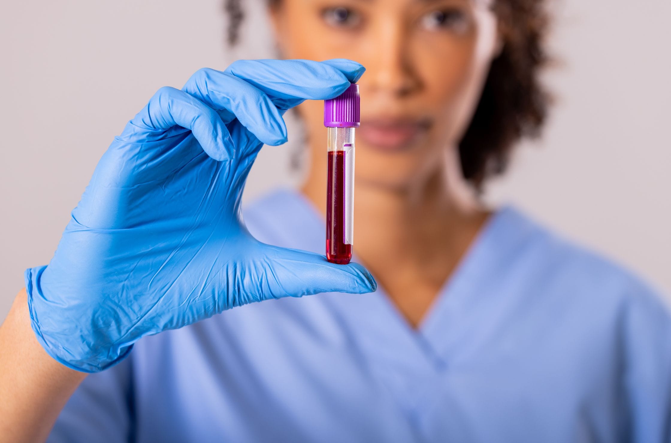Blood Test Adelaide | Accurate Health Testing & Analysis