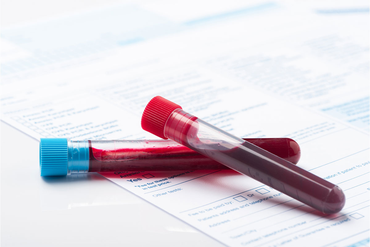 Blood Tests Adelaide | Haus of Holistic Health